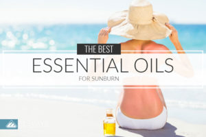 The Best Essential Oils for Sunburn and How to Use Them - Elevays